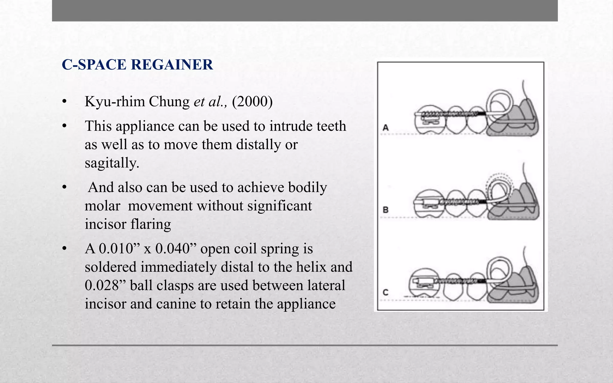 Molar distalisation in Orthodontics | PPTX | Dental Health | Diseases ...