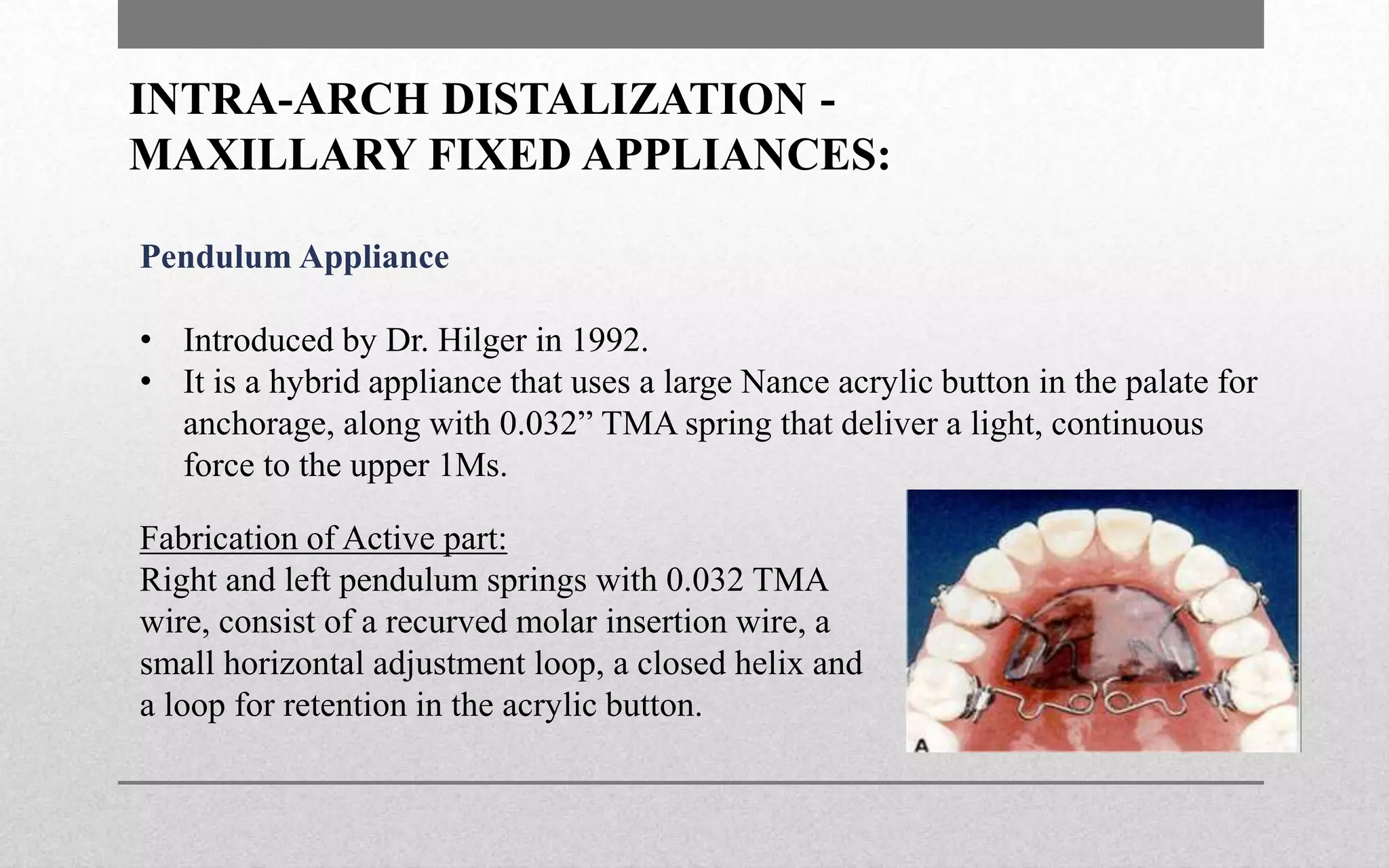 Molar distalisation in Orthodontics | PPTX
