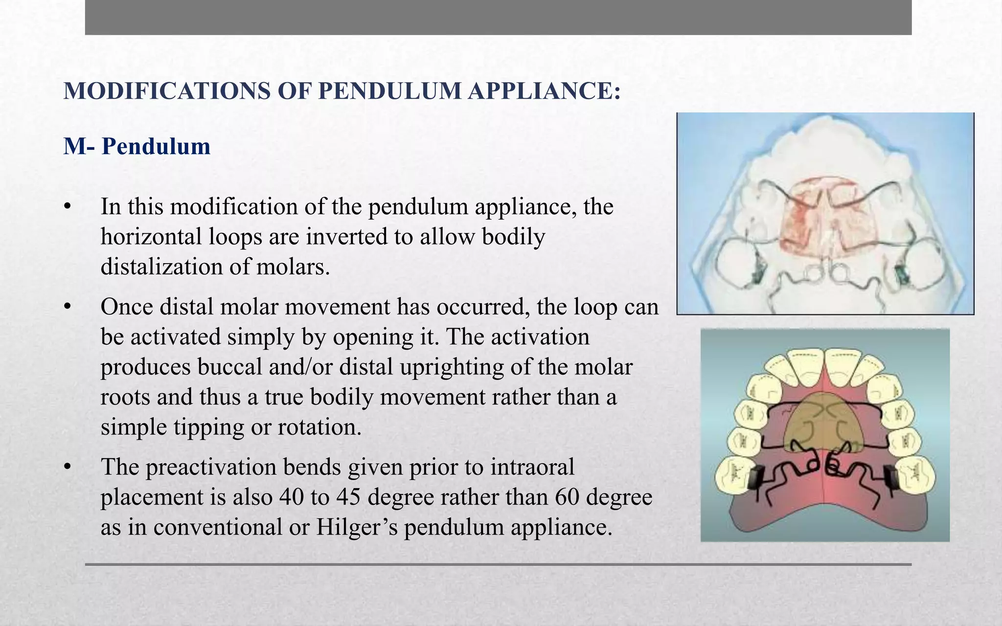 Molar distalisation in Orthodontics | PPTX