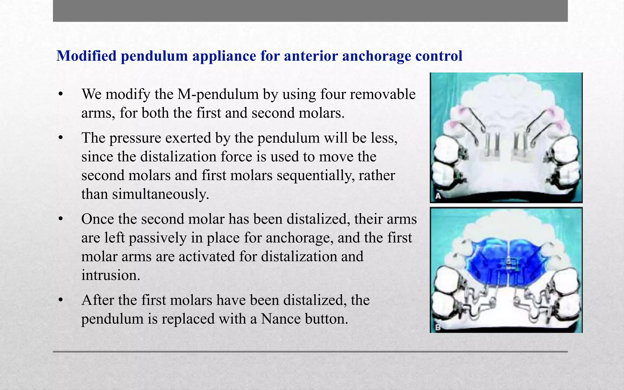 Molar distalisation in Orthodontics | PPTX | Dental Health | Diseases ...
