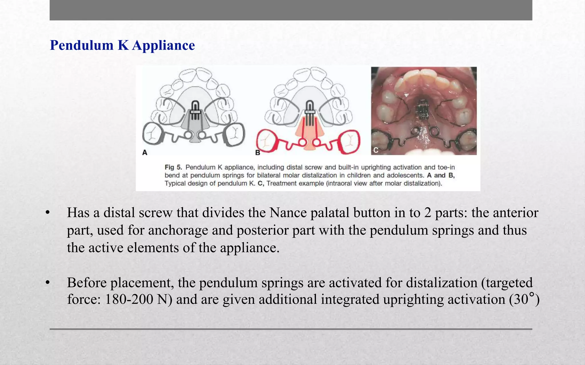 Molar distalisation in Orthodontics | PPTX