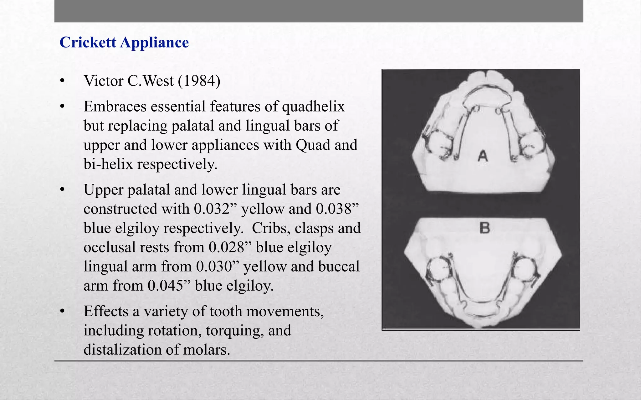 Molar distalisation in Orthodontics | PPTX