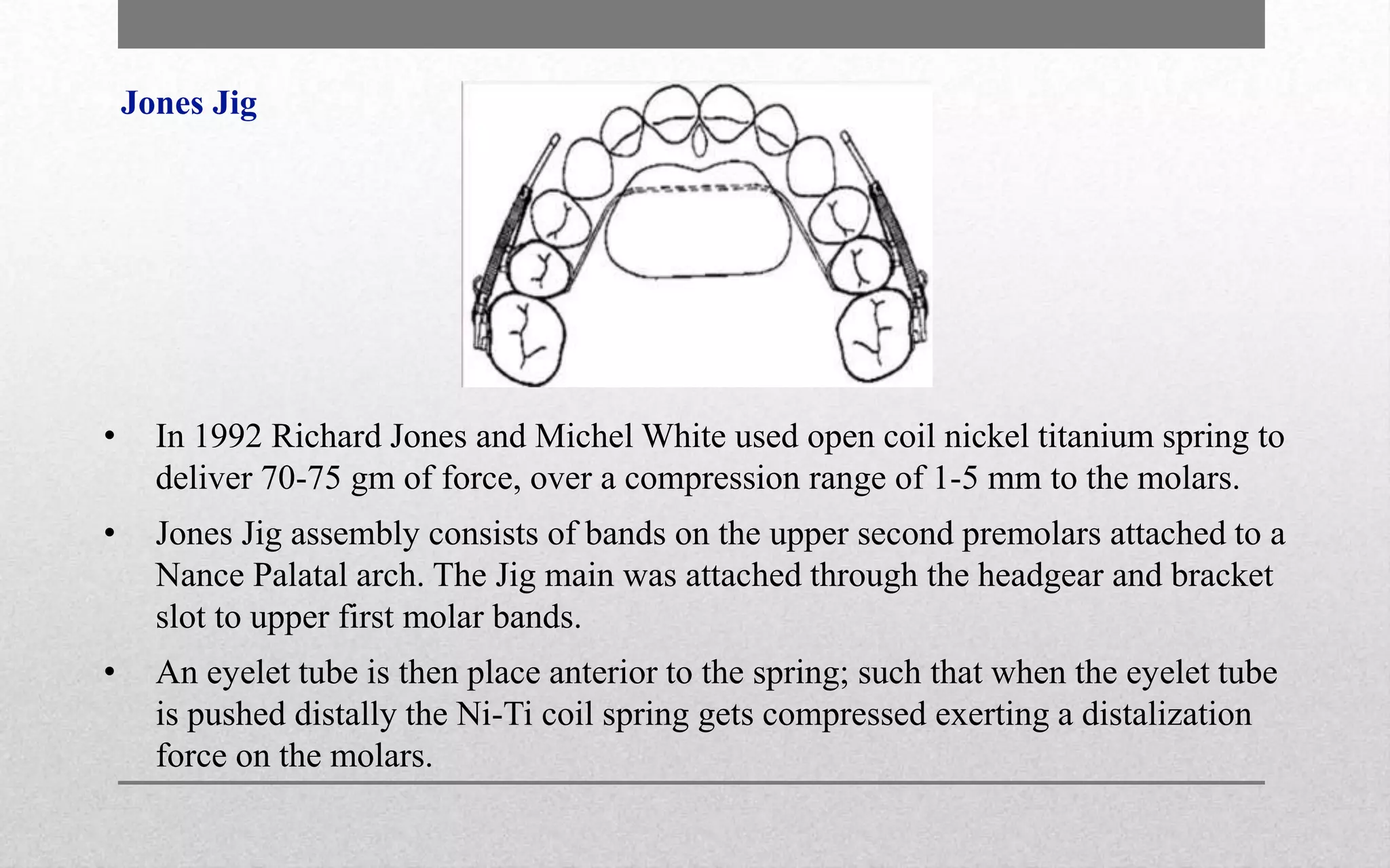 Molar distalisation in Orthodontics | PPTX