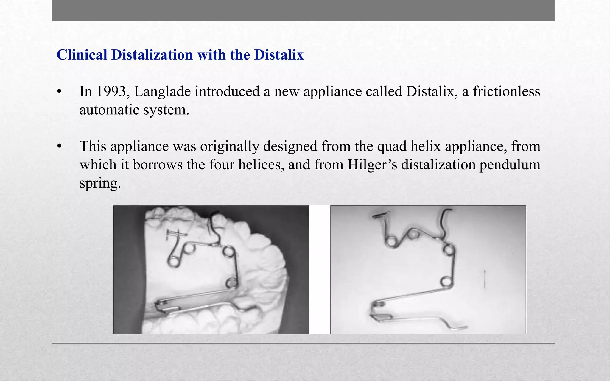 Molar distalisation in Orthodontics | PPTX