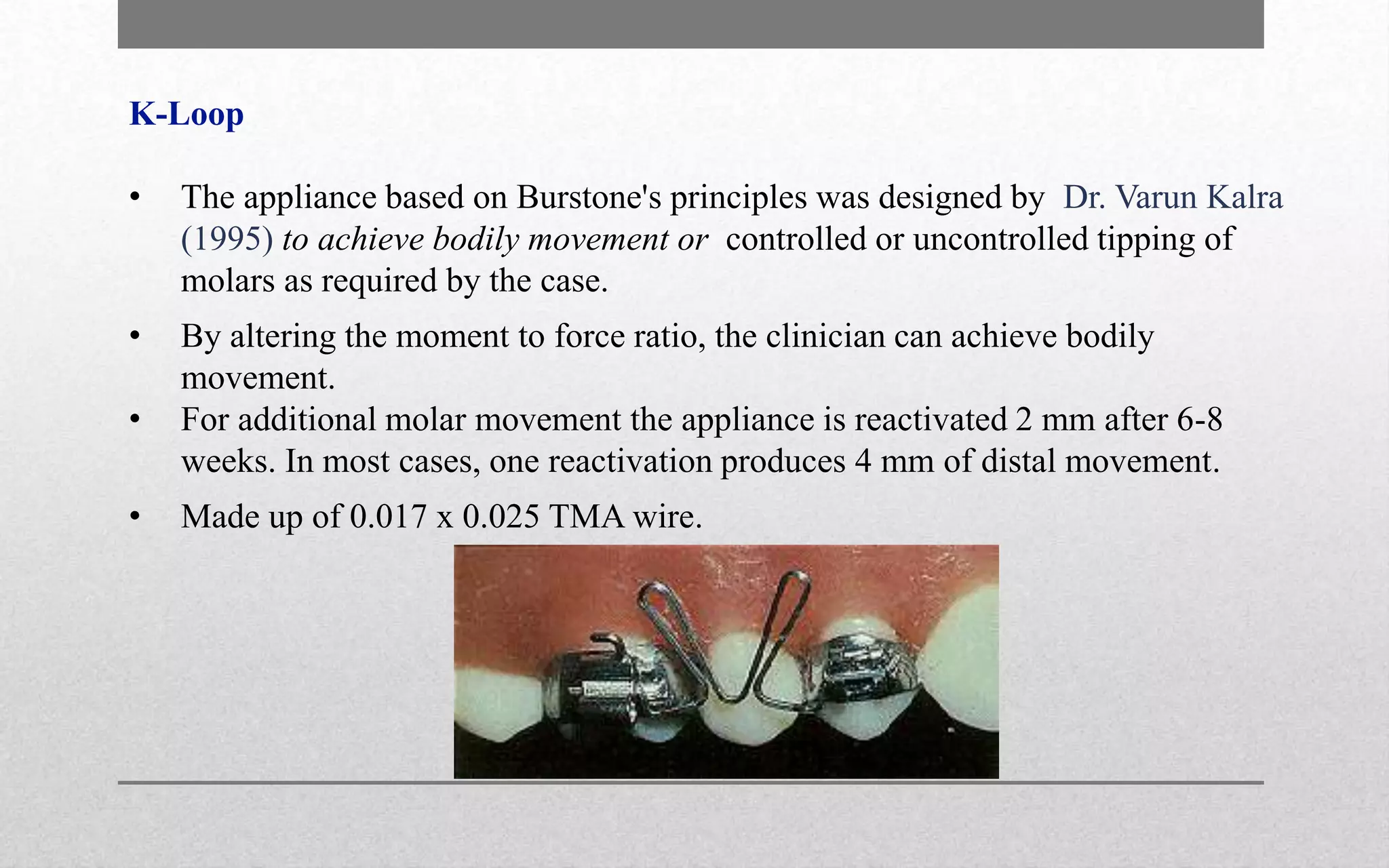 Molar distalisation in Orthodontics | PPTX