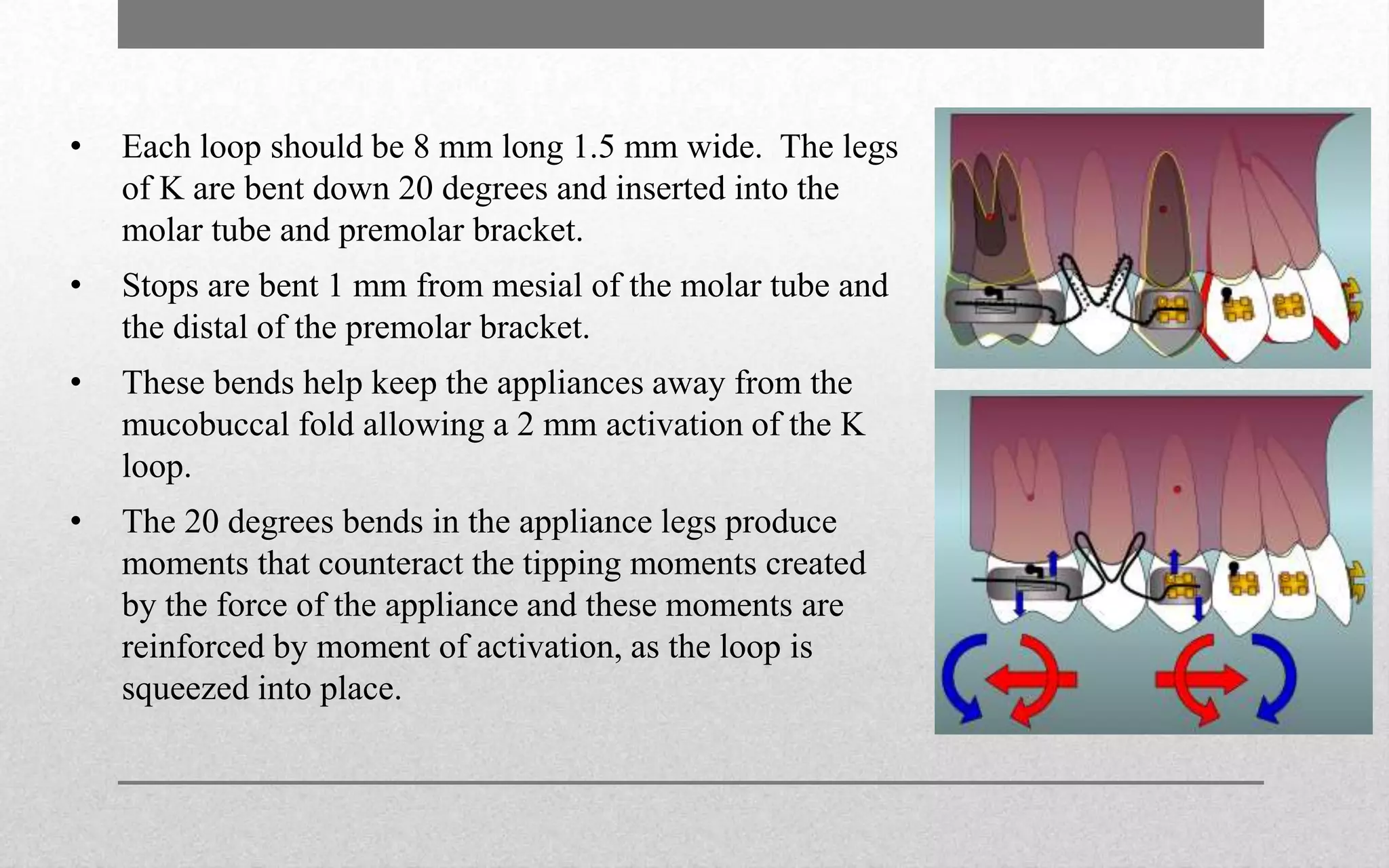 Molar distalisation in Orthodontics | PPTX