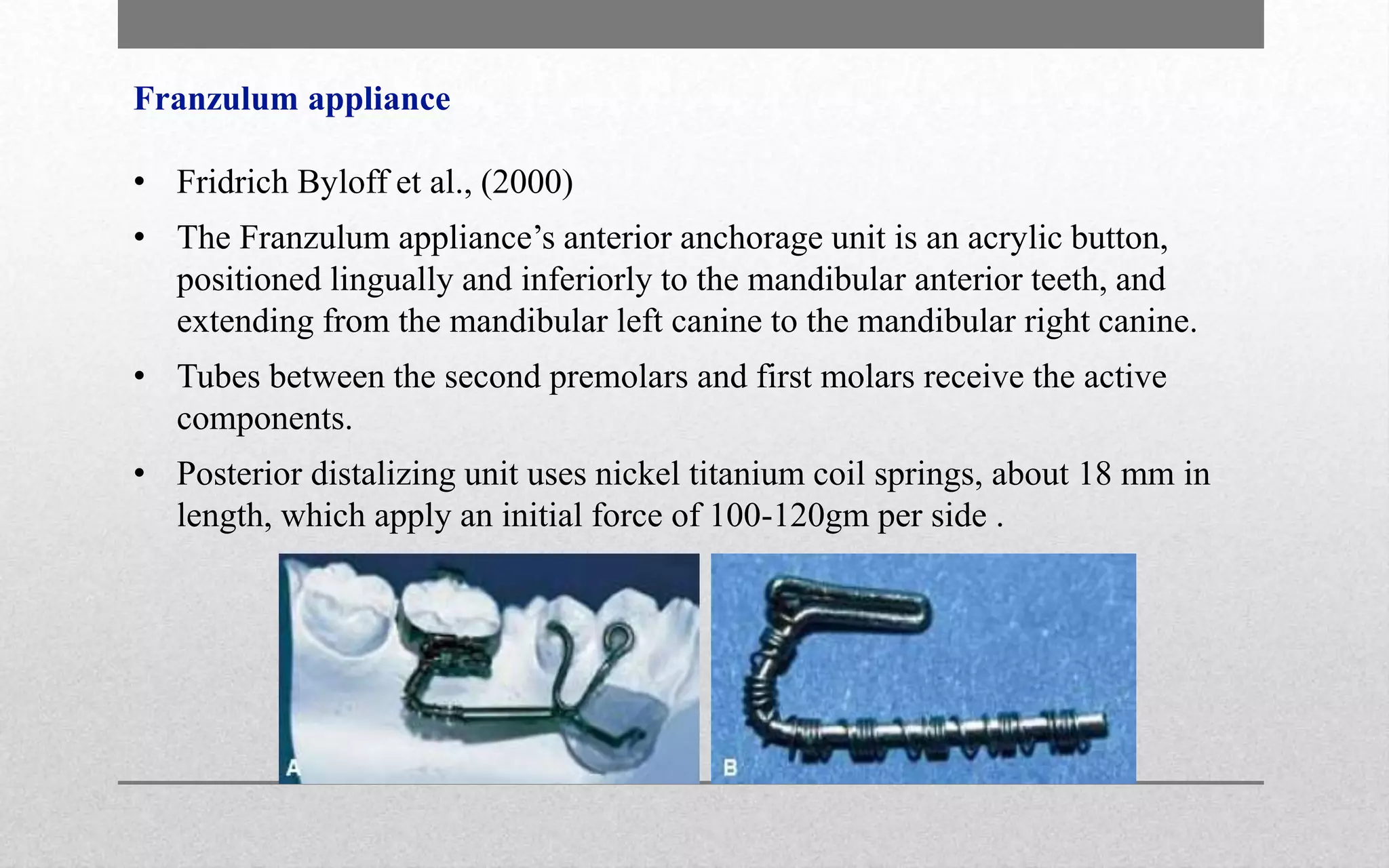 Molar distalisation in Orthodontics | PPTX