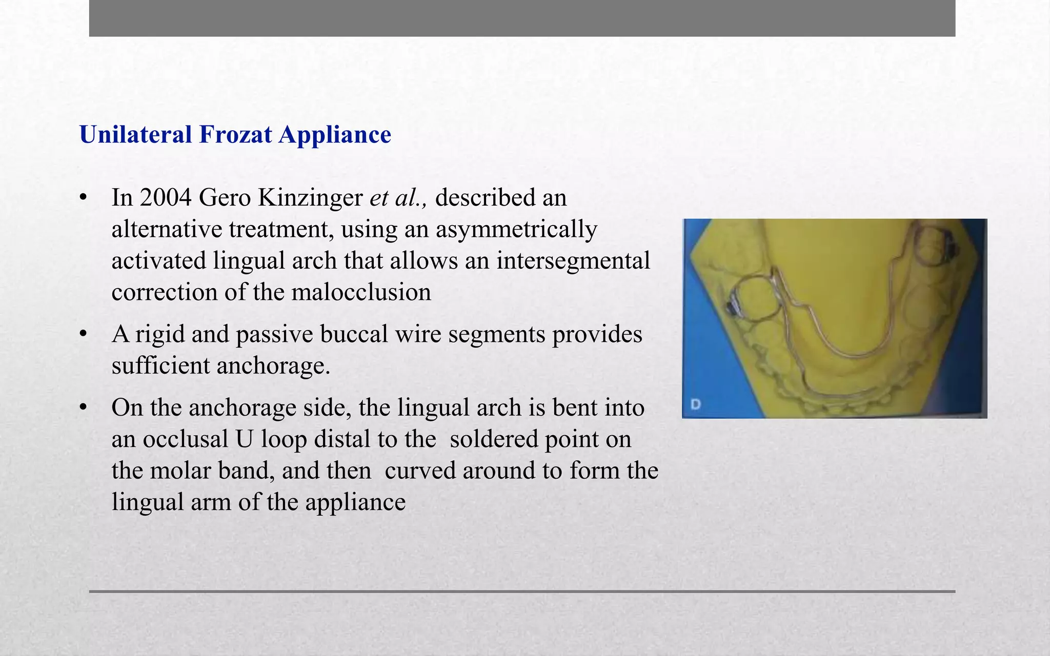 Molar distalisation in Orthodontics | PPTX