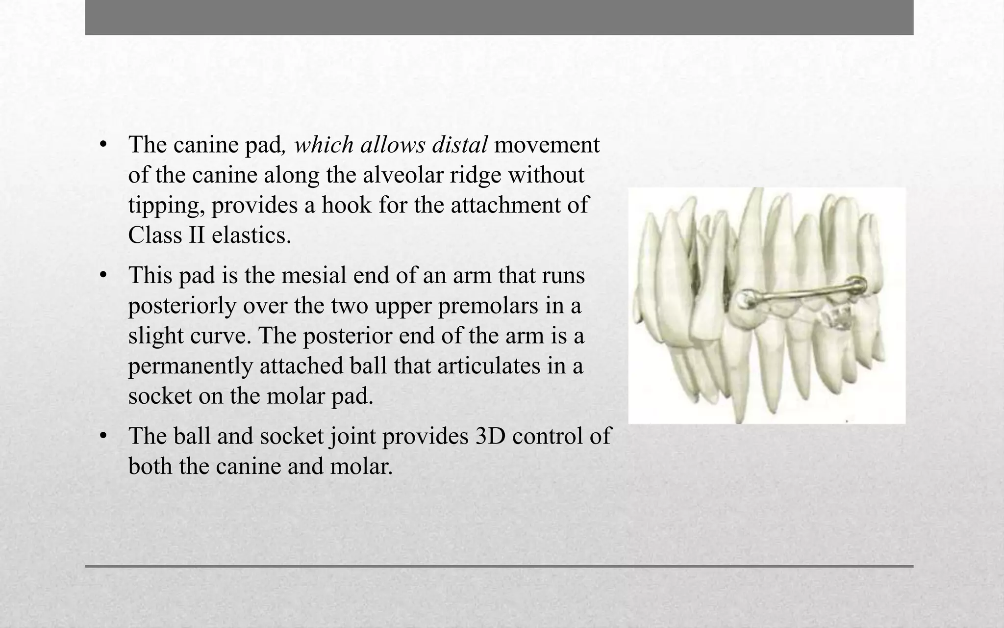 Molar distalisation in Orthodontics | PPTX