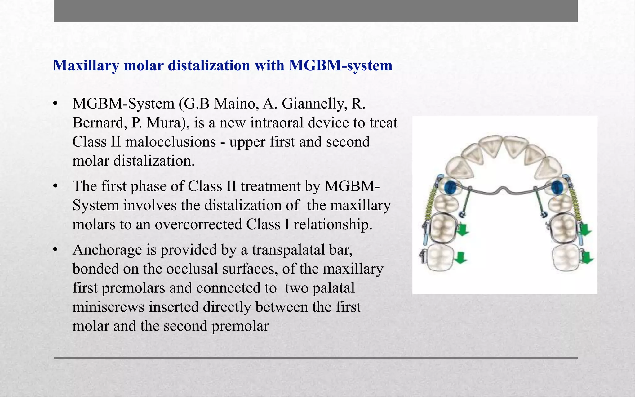 Molar distalisation in Orthodontics | PPTX