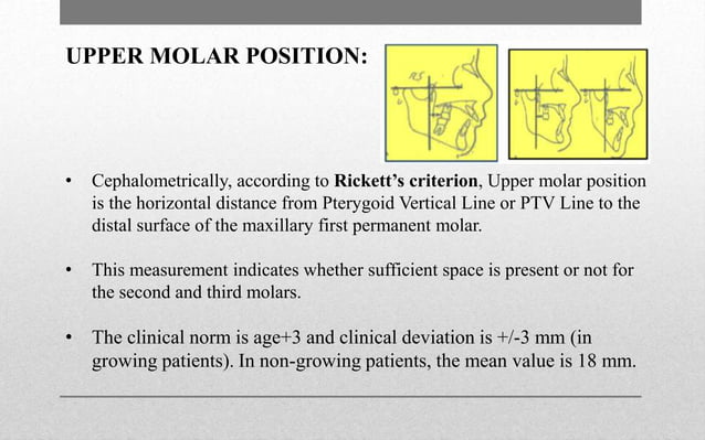 Molar distalisation in Orthodontics | PPTX | Dental Health | Diseases ...