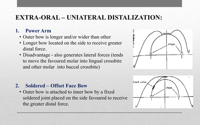 Molar distalisation in Orthodontics | PPTX | Dental Health | Diseases ...