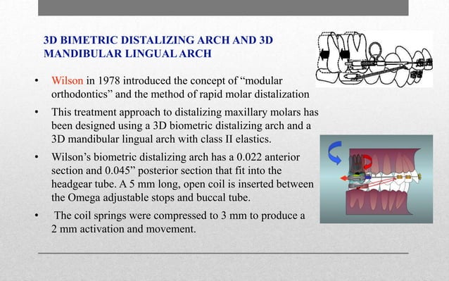 Molar distalisation in Orthodontics | PPTX | Dental Health | Diseases ...