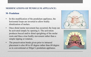 Molar distalisation in Orthodontics | PPTX