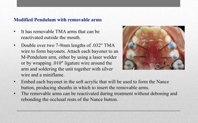 Molar distalisation in Orthodontics | PPTX | Dental Health | Diseases ...