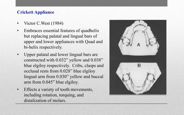 Molar distalisation in Orthodontics | PPTX | Dental Health | Diseases ...