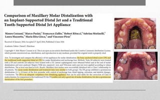 Molar distalisation in Orthodontics | PPTX