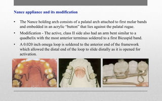 Molar distalisation in Orthodontics | PPTX