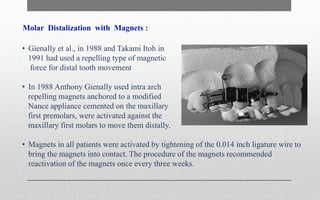 Molar distalisation in Orthodontics | PPTX