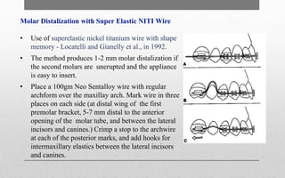 Molar distalisation in Orthodontics | PPTX