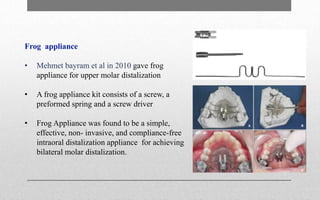 Molar distalisation in Orthodontics | PPTX