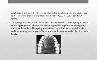 Molar distalisation in Orthodontics | PPTX