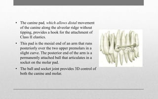 Molar distalisation in Orthodontics | PPTX
