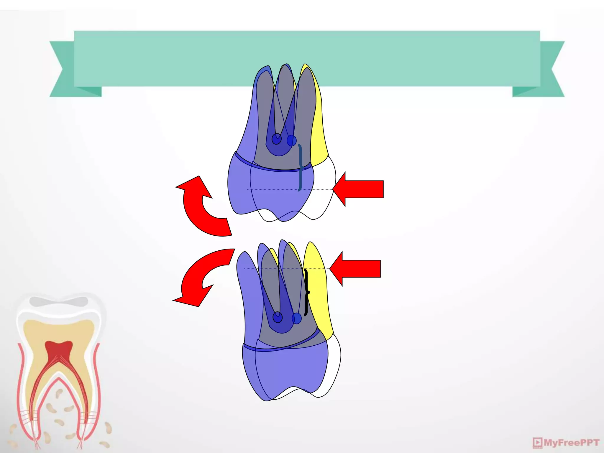 Molar distalization | PPTX