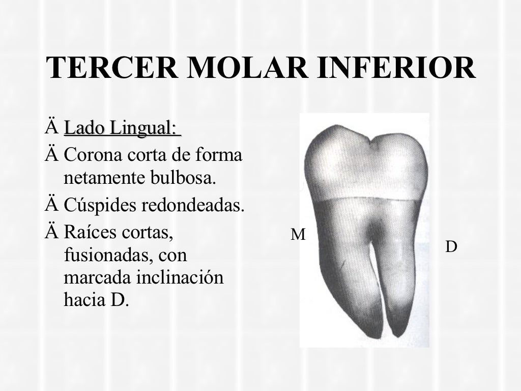 Anatomia Dos Molares Inferiores - RETOEDU