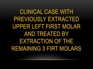 Molar extractions in orthodontics | PPTX