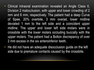 Molar extractions in orthodontics | PPTX