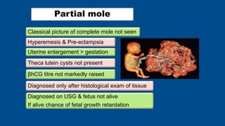 molar for class.pptx