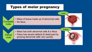 molar for class.pptx