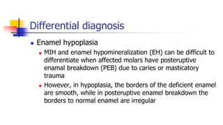 Molar incisor hypomineralization (MIH) ojus | PPTX