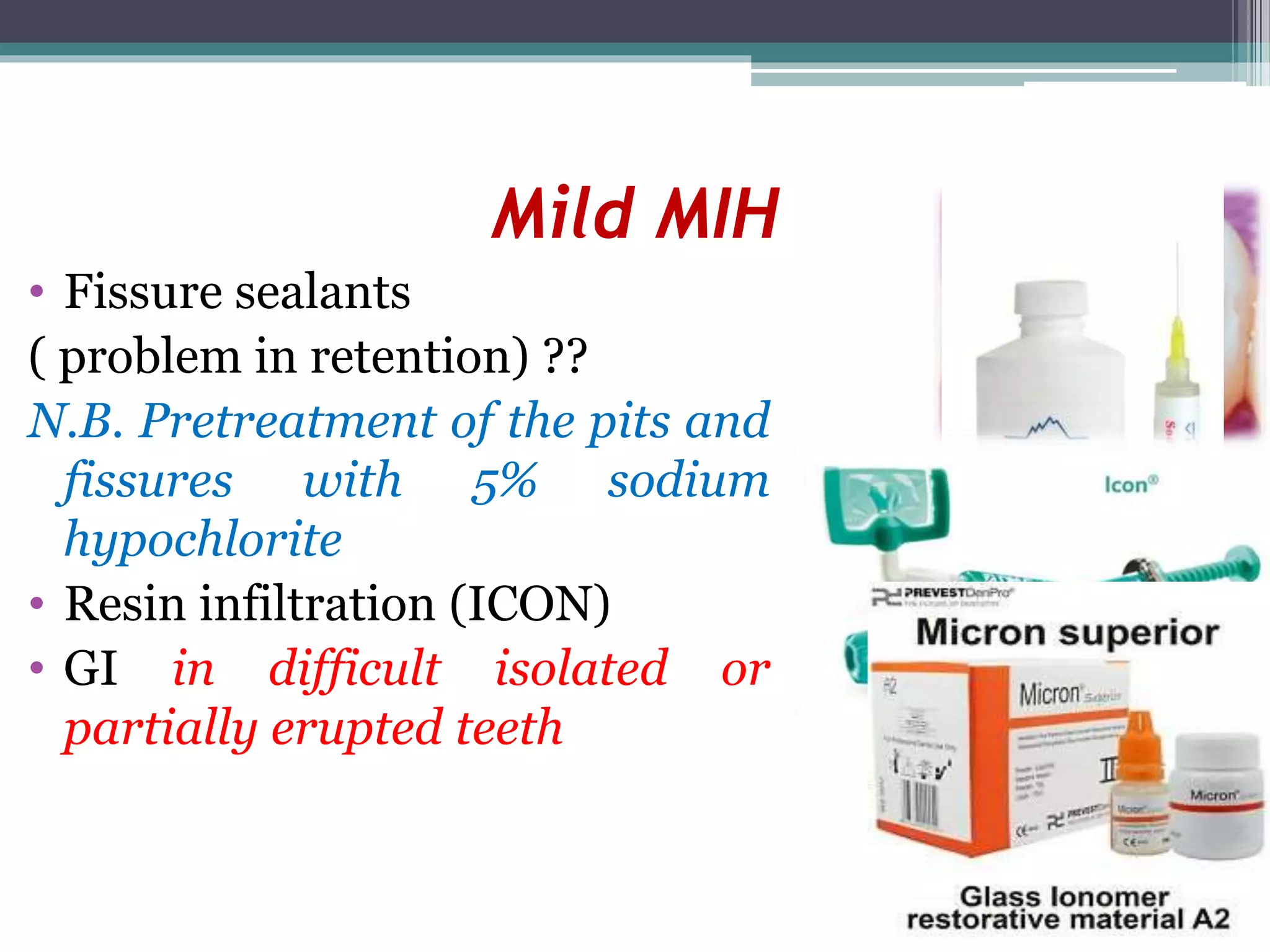 Molar incisor hypomineralization | PPTX