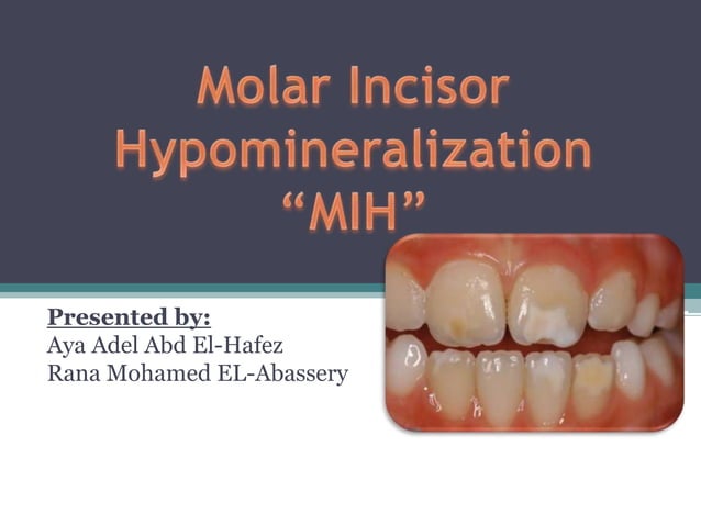 Molar incisor hypomineralization | PPTX