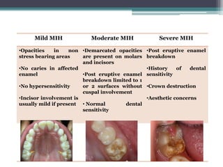 Molar incisor hypomineralization | PPTX