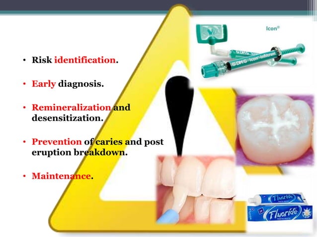 Molar incisor hypomineralization | PPTX