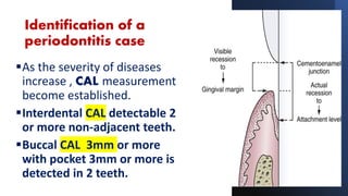 Noval treatment approach of Molar Incisor Pattern PERIODONTITIS ...