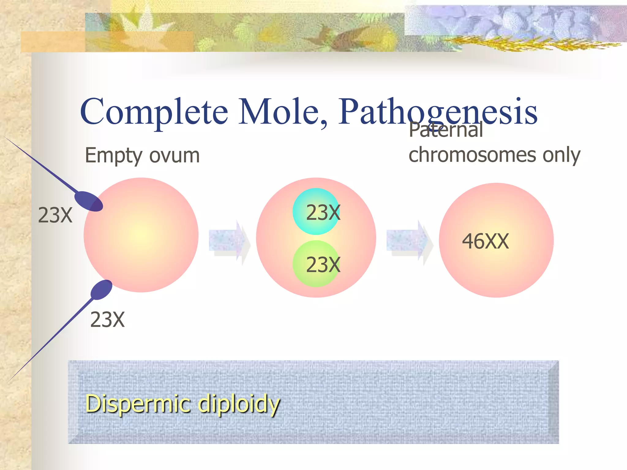 Molar pregnancy | PPTX