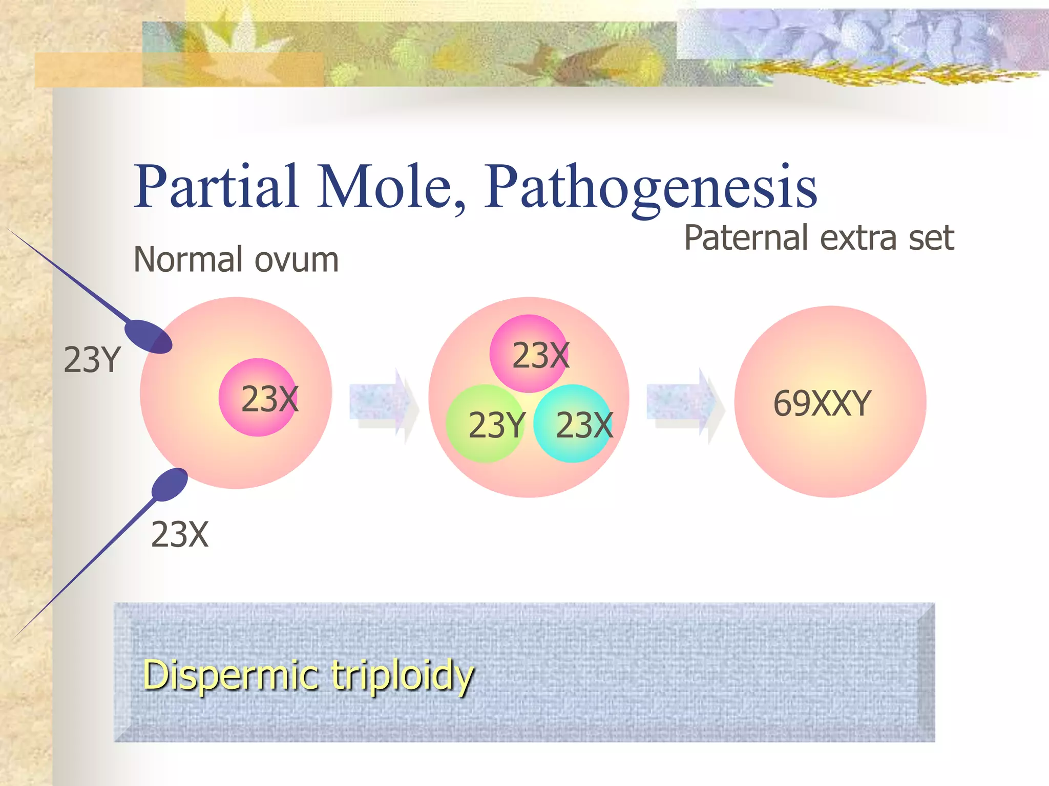 Molar pregnancy | PPTX