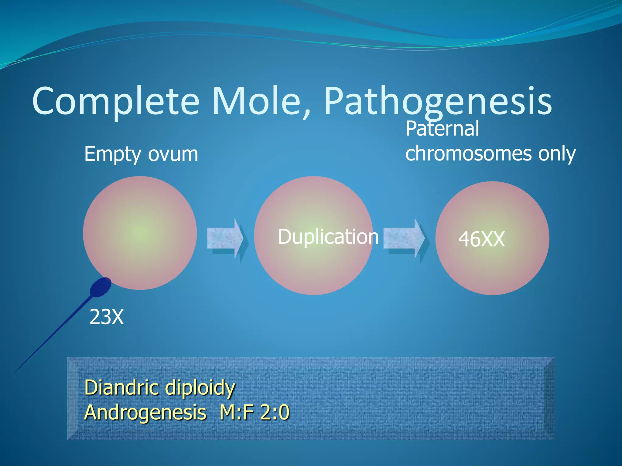 Molar pregnancy | PPTX