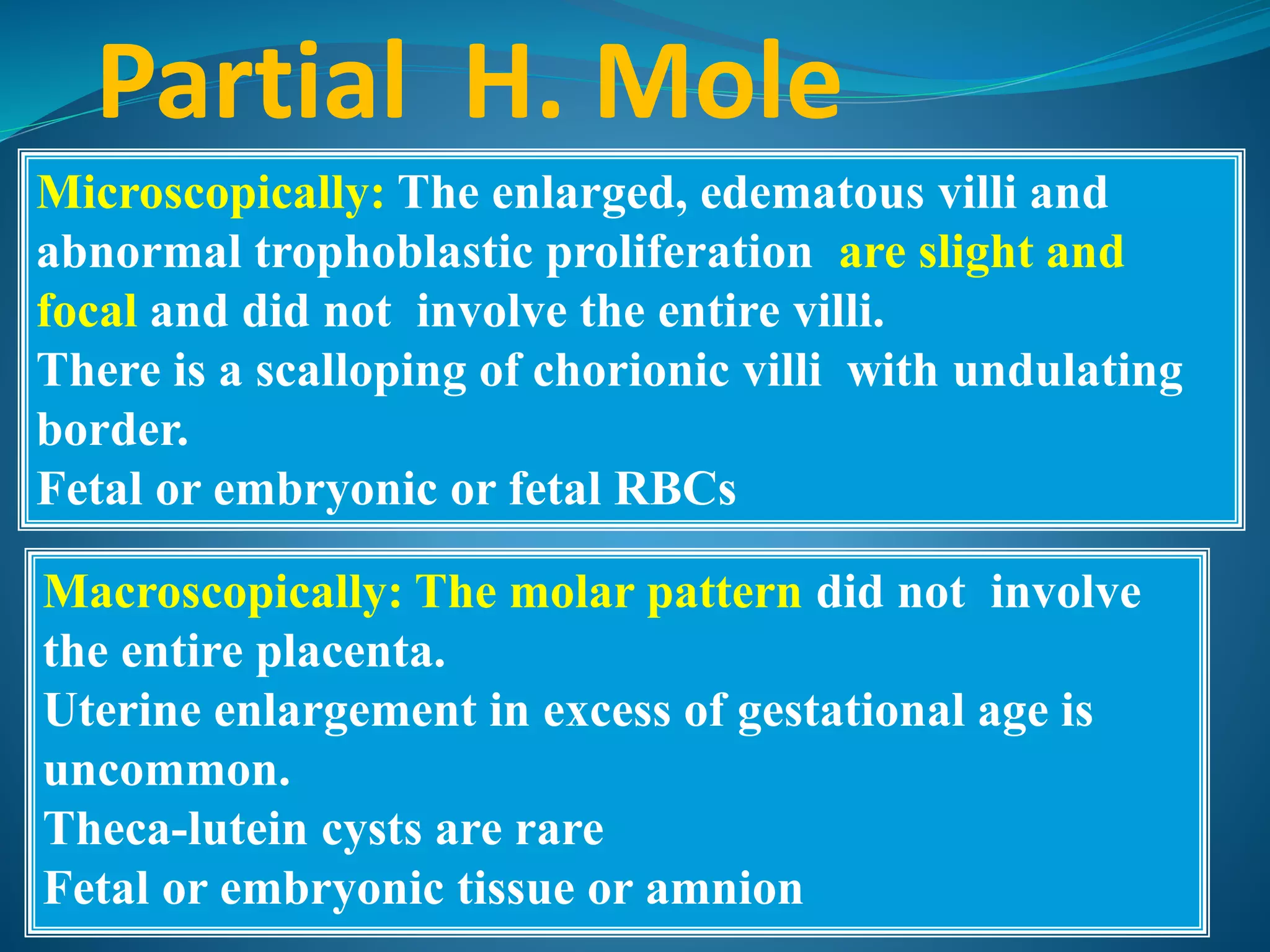 Molar pregnancy | PPTX