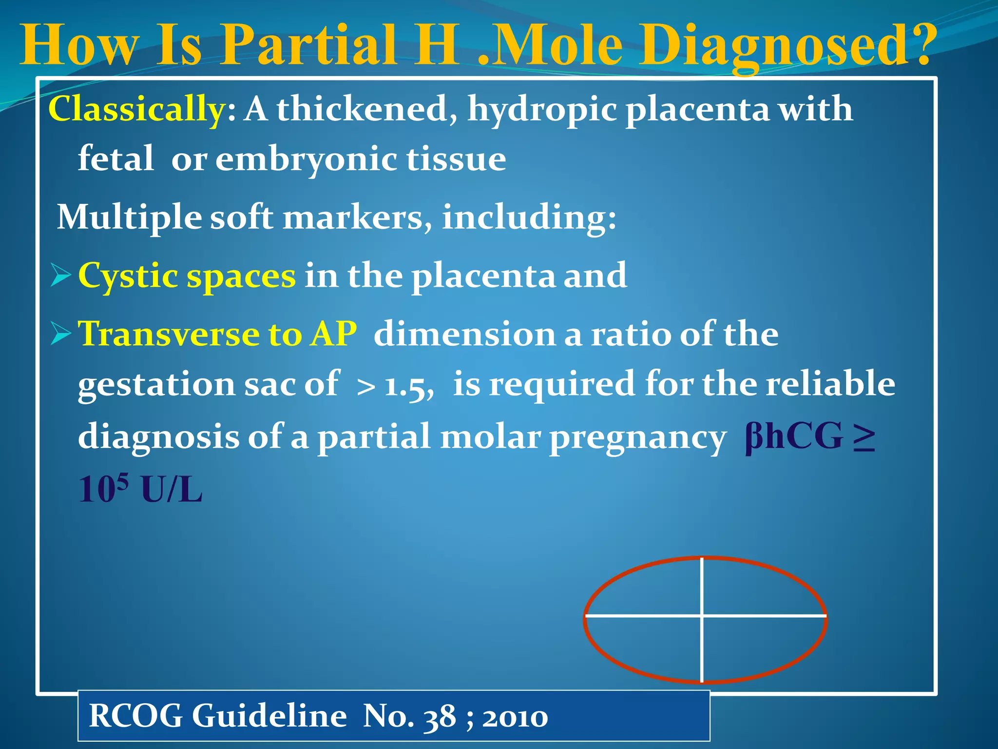 Molar pregnancy | PPTX