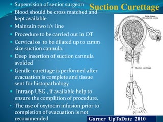 Suction Curettage Molar Pregnancy