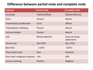 molar pregnancy.pptx