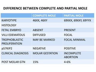 Molar Pregnancy Complete Vs Incomplete Hydatidiform Mole.pptxpptx | PPTX