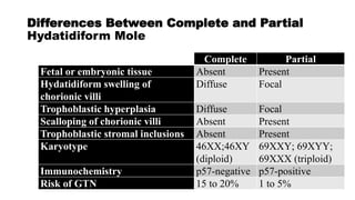 Molar Pregnancy or Hydatidiform mole.pptx