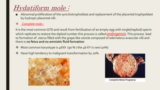 Molar pregnancy from a-z | PPTX