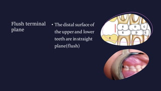 Molar relationship pedo | PPTX